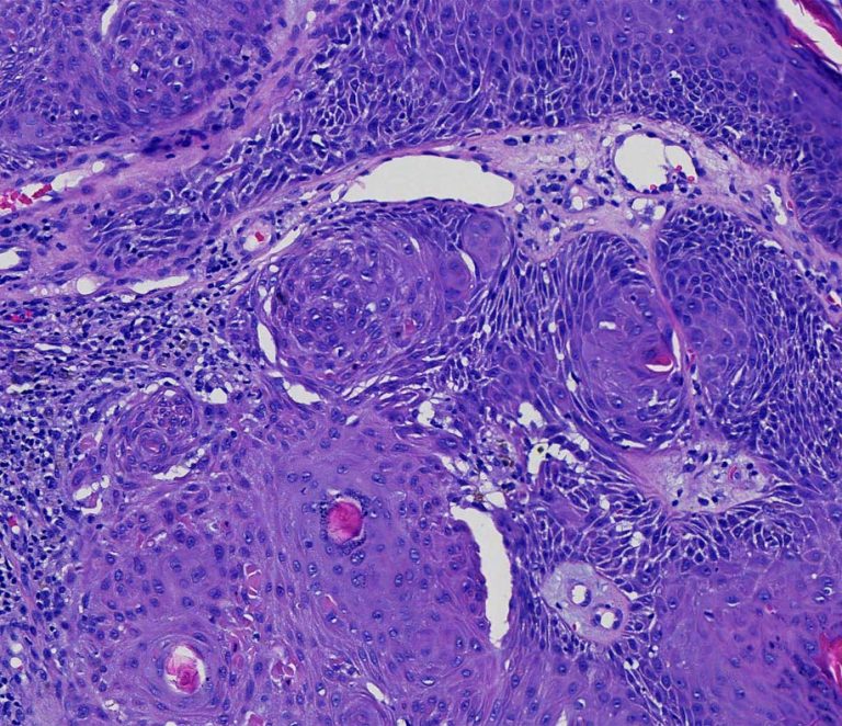 Dermatopathology Lab Services | Sagis Diagnostics