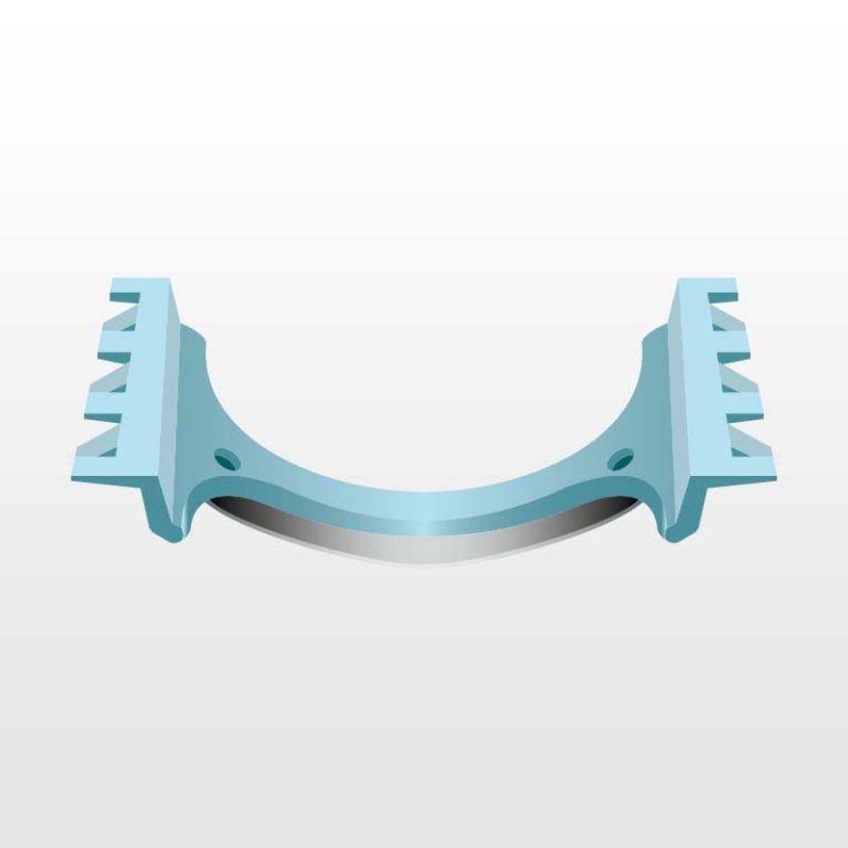 Fine Needle Aspiration Collection (Including Gout) | Sagis