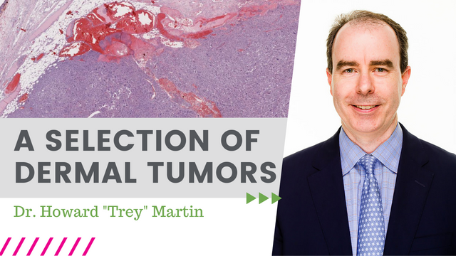A Selection of Dermal Tumors | Sagis