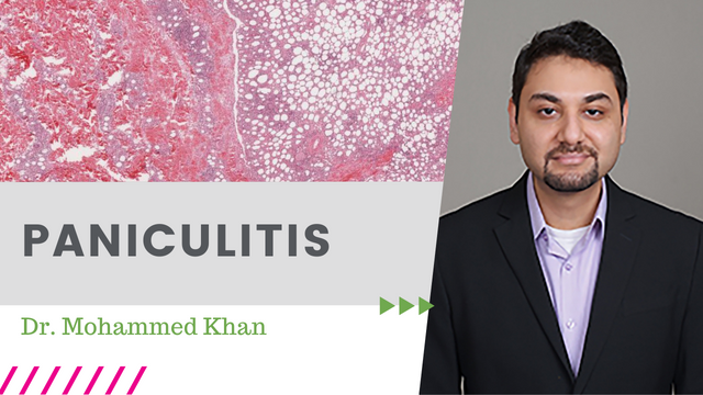 Panniculitis - Sagis