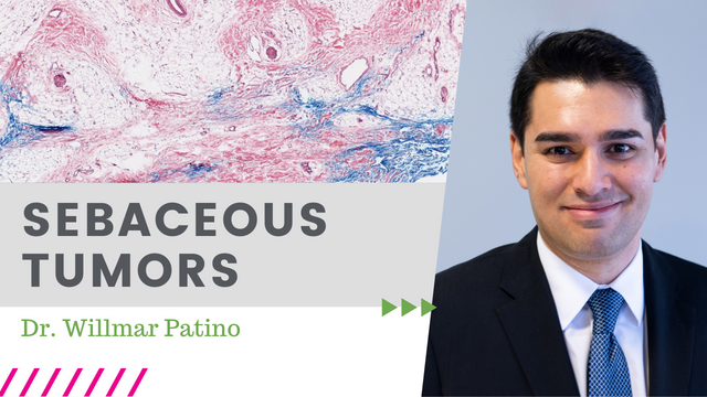Sebaceous Tumors | Sagis