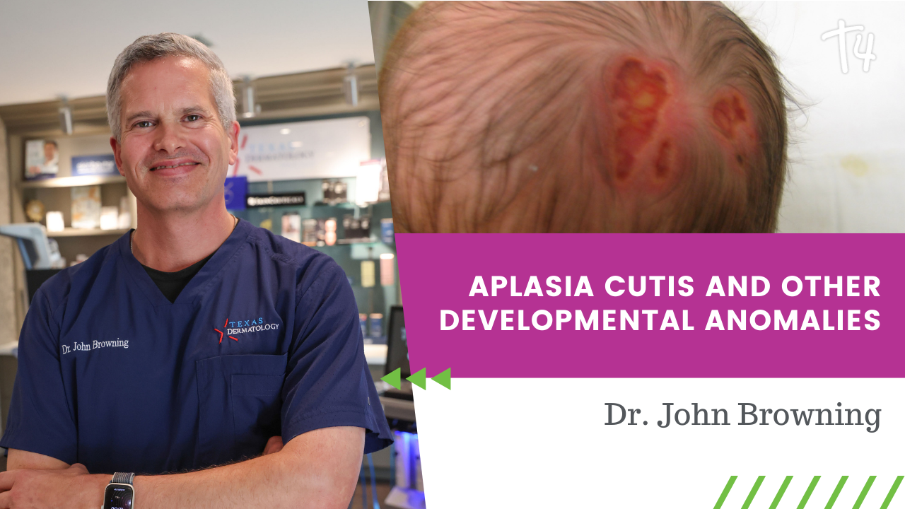 Aplasia Cutis and Other Developmental Anomalies | Sagis
