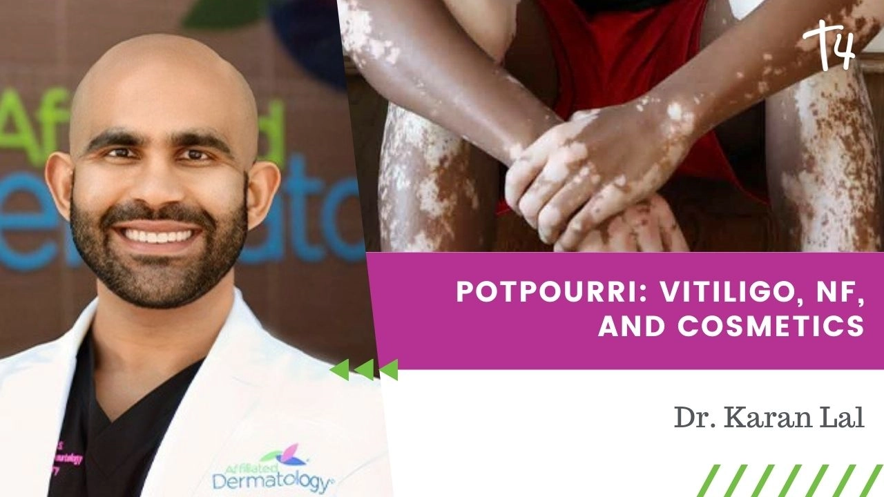 Vitiligo: Nuances in Treating Kids | Sagis