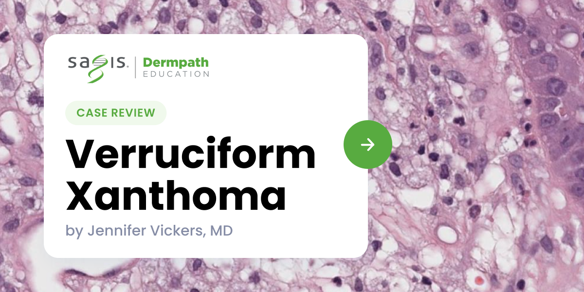 Dermpath Educational Library | Sagis